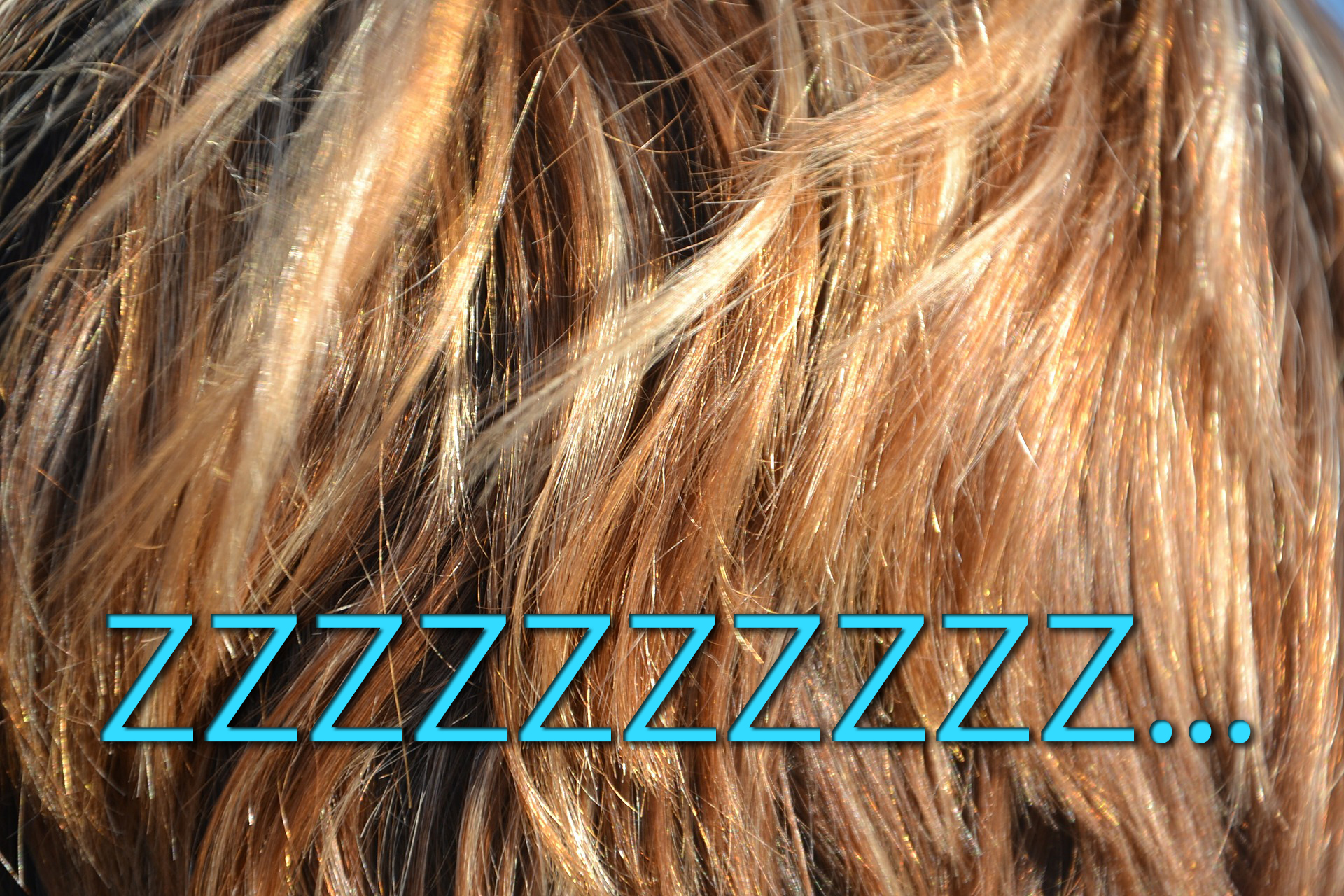Telogen Effluvium Hair Loss in IBD • Dan Sharp